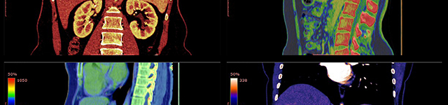 Researchers Leverage Two Photon Microscopy and Mesoscopic Imaging to ...