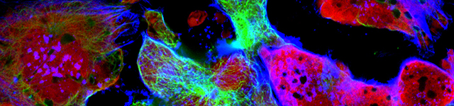 What Is Automated Confocal Microscopy for Life Sciences? | automate.org