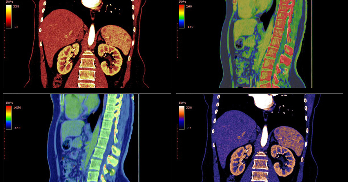 UC Berkeley Announces Advanced Bioimaging Center, Aims to Promote Imaging Technology in Life ...