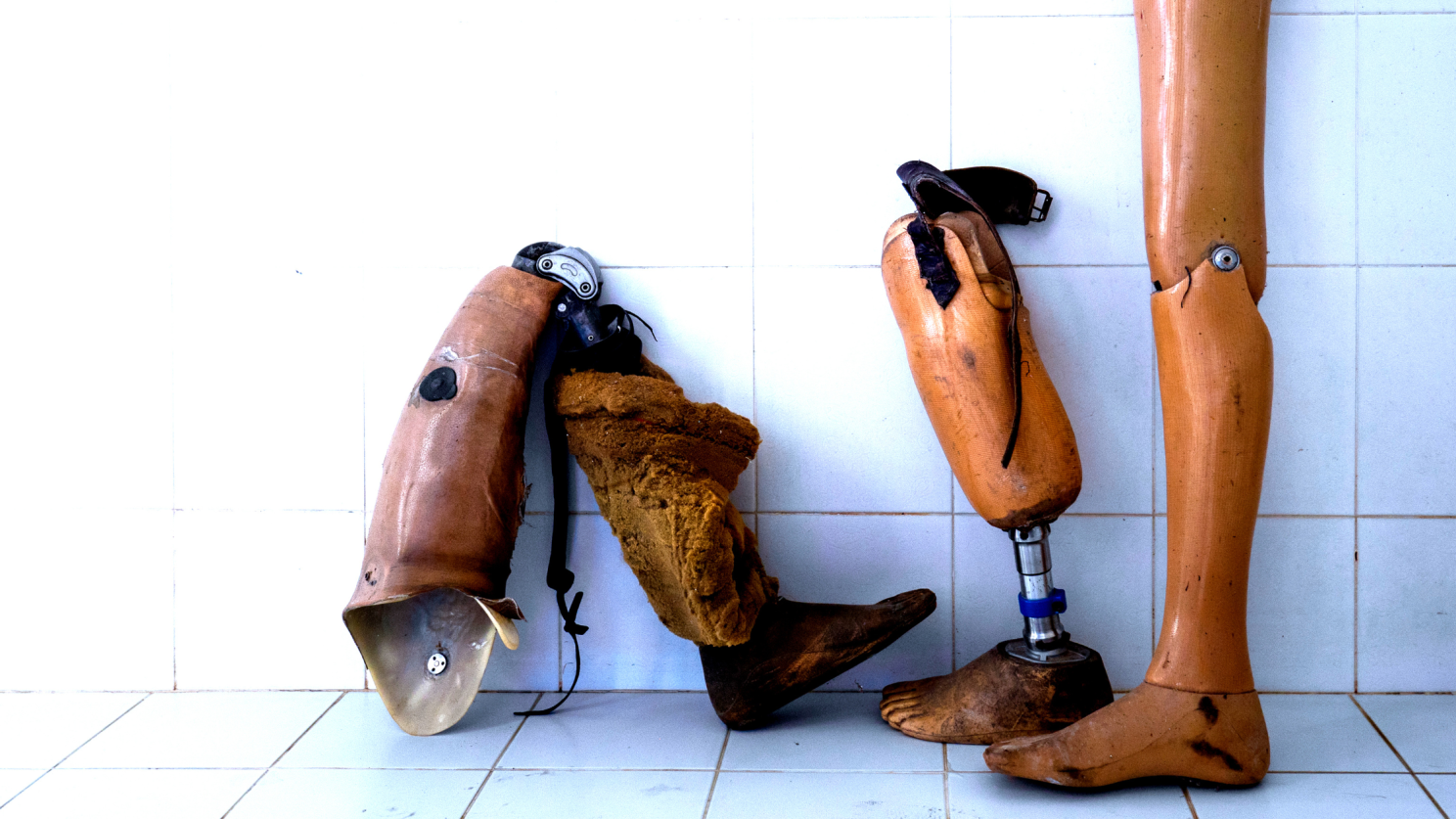 News: The Possibilities of Next-Generation Prosthetics | Asamaka ...