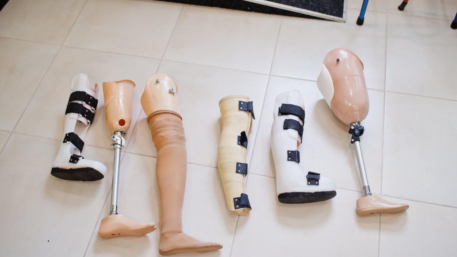 News: The Possibilities of Next-Generation Prosthetics | Asamaka ...